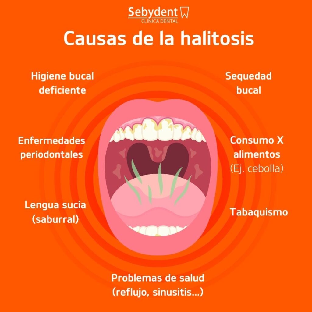 Halitosis: Origen, Causas Y Tratamiento Para Combatirla – YOFR